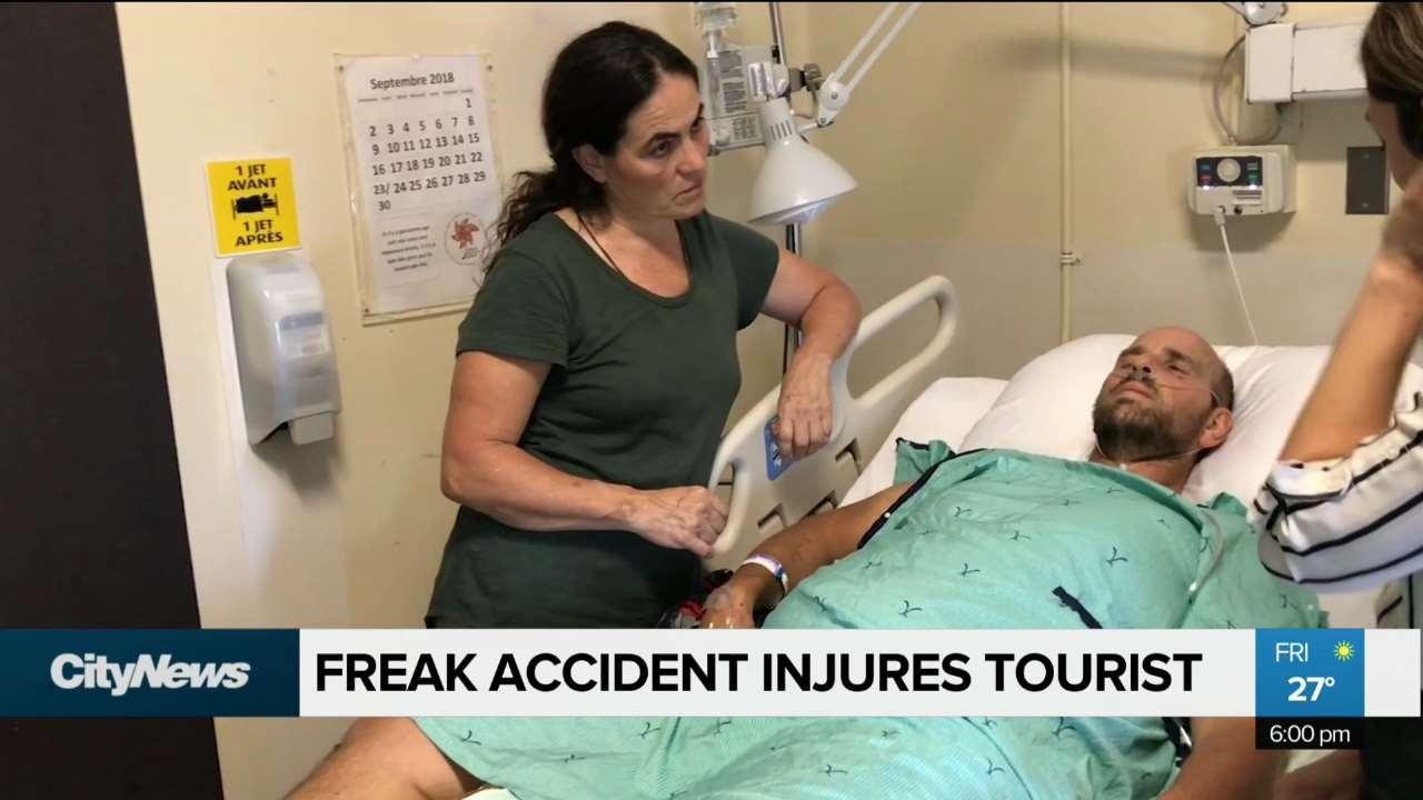 Tourist injured in freak accident