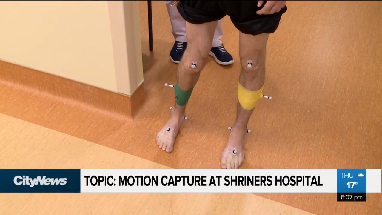 Motion capture medical marvel